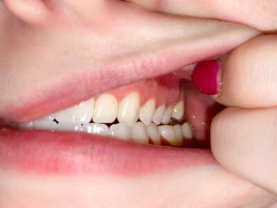 Virtual Smile Assessment - Fair Lakes Family and Cosmetic Dentistry